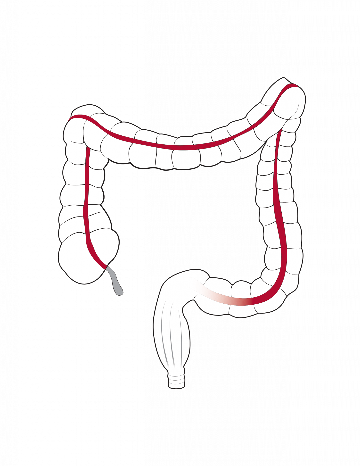 Colon and Rectal Surgery | Department of Surgery | Washington ...