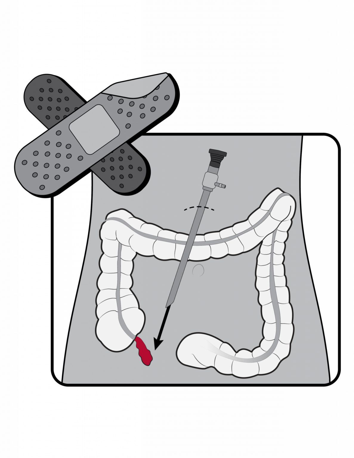 Minimally Invasive Surgery | Department of Surgery | Washington ...