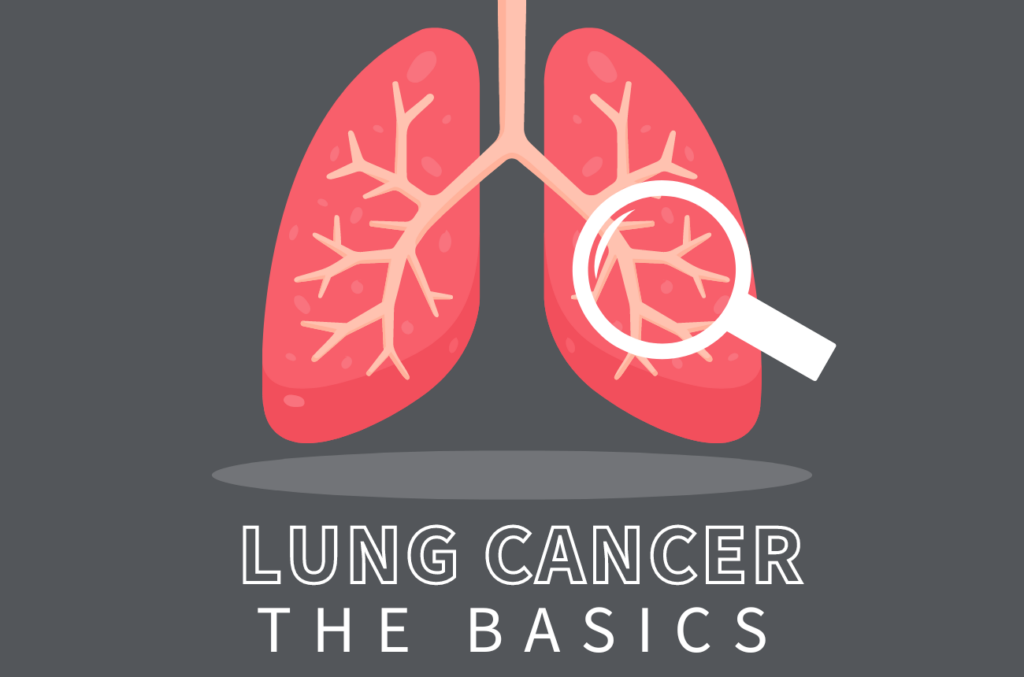 Lung Cancer – The Basics | Department of Surgery | Washington ...