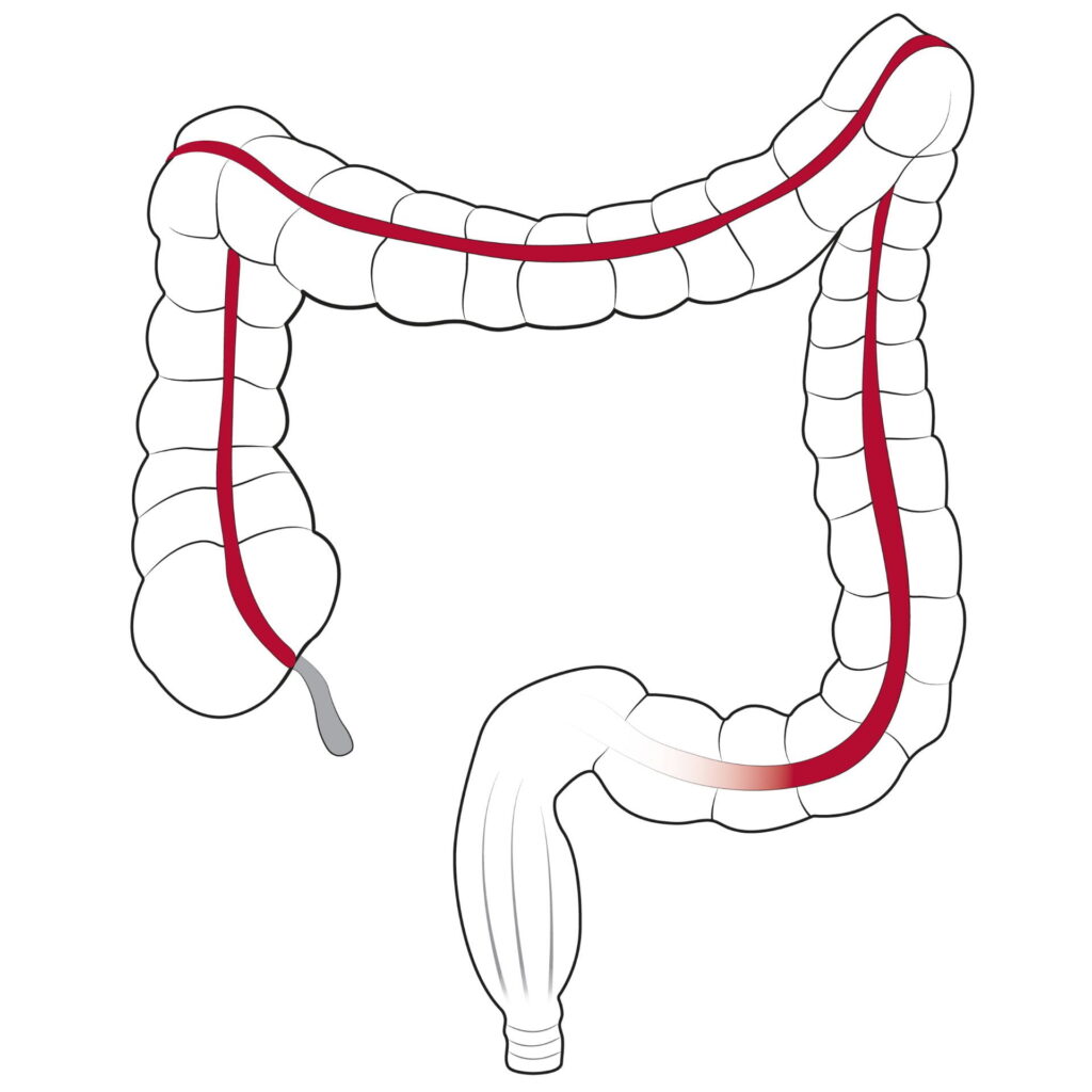 Colon and Rectal Surgery | Department of Surgery | Washington ...
