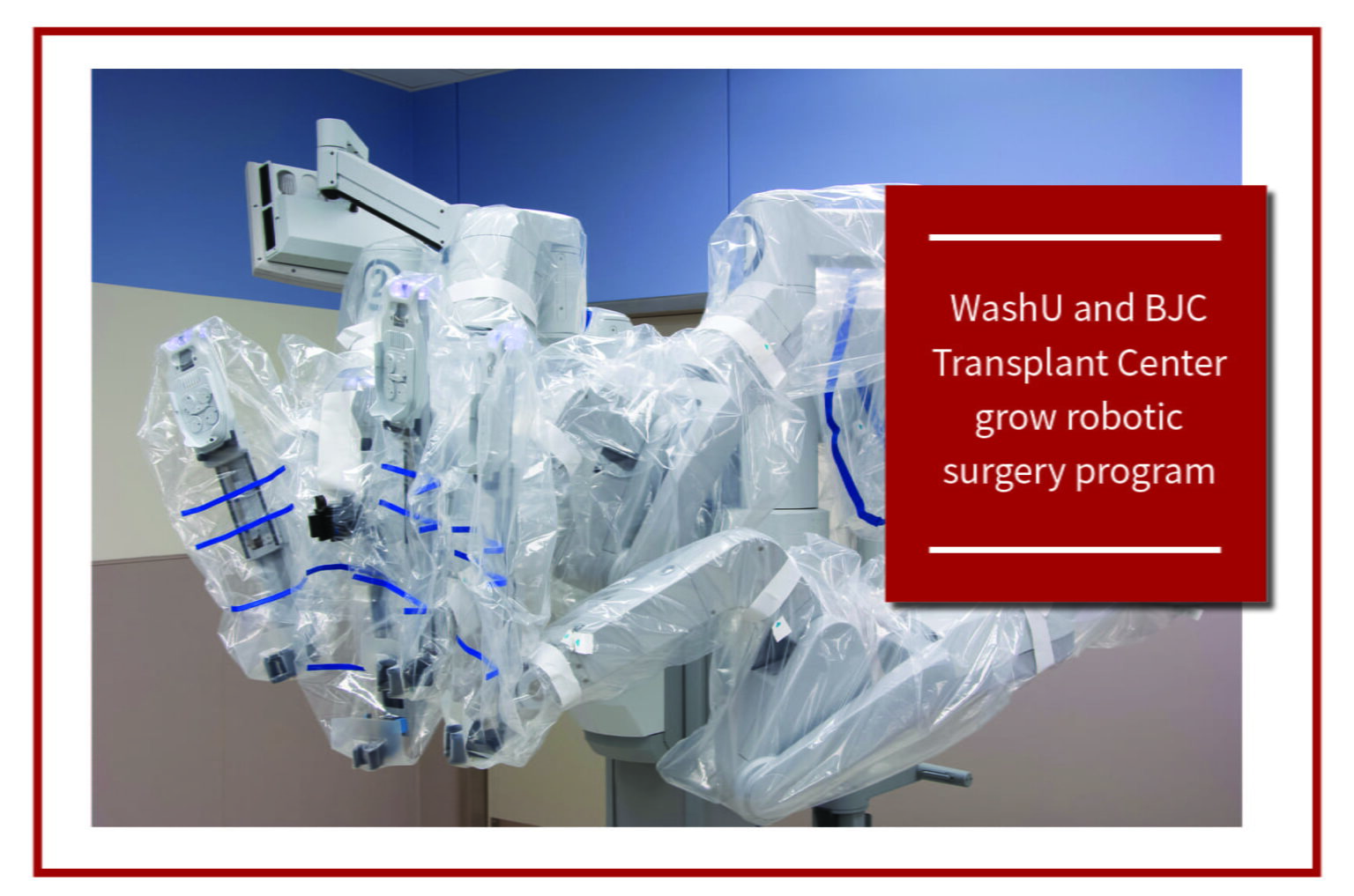 Changing the Playing Field: Robotic Surgery in Transplantation ...