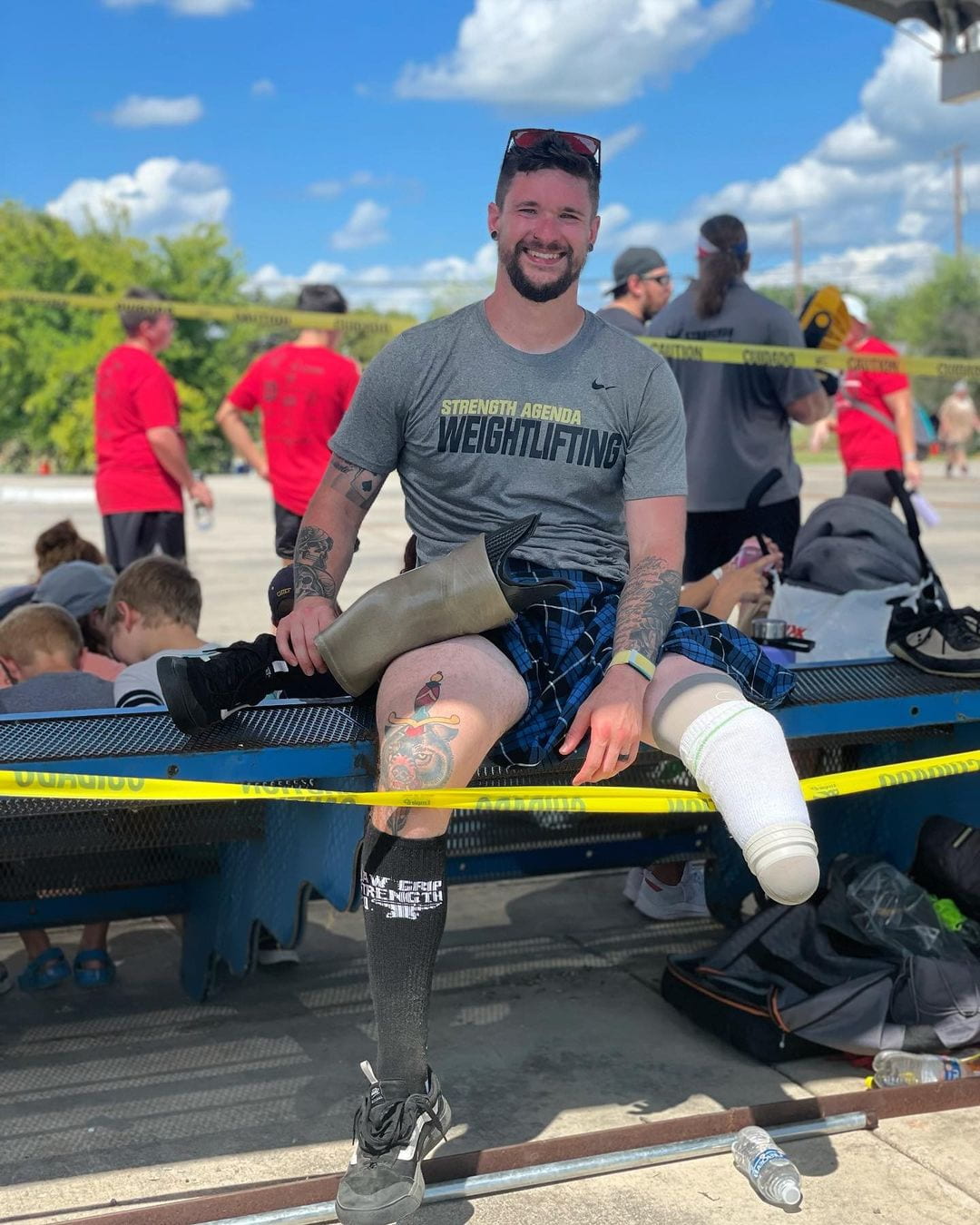 Coaching After Amputation: Sam’s Story | Department of Surgery ...